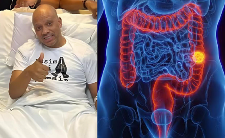 Câncer inguinal: conheça a doença que m4tou Anderson Leonardo do grupo ...